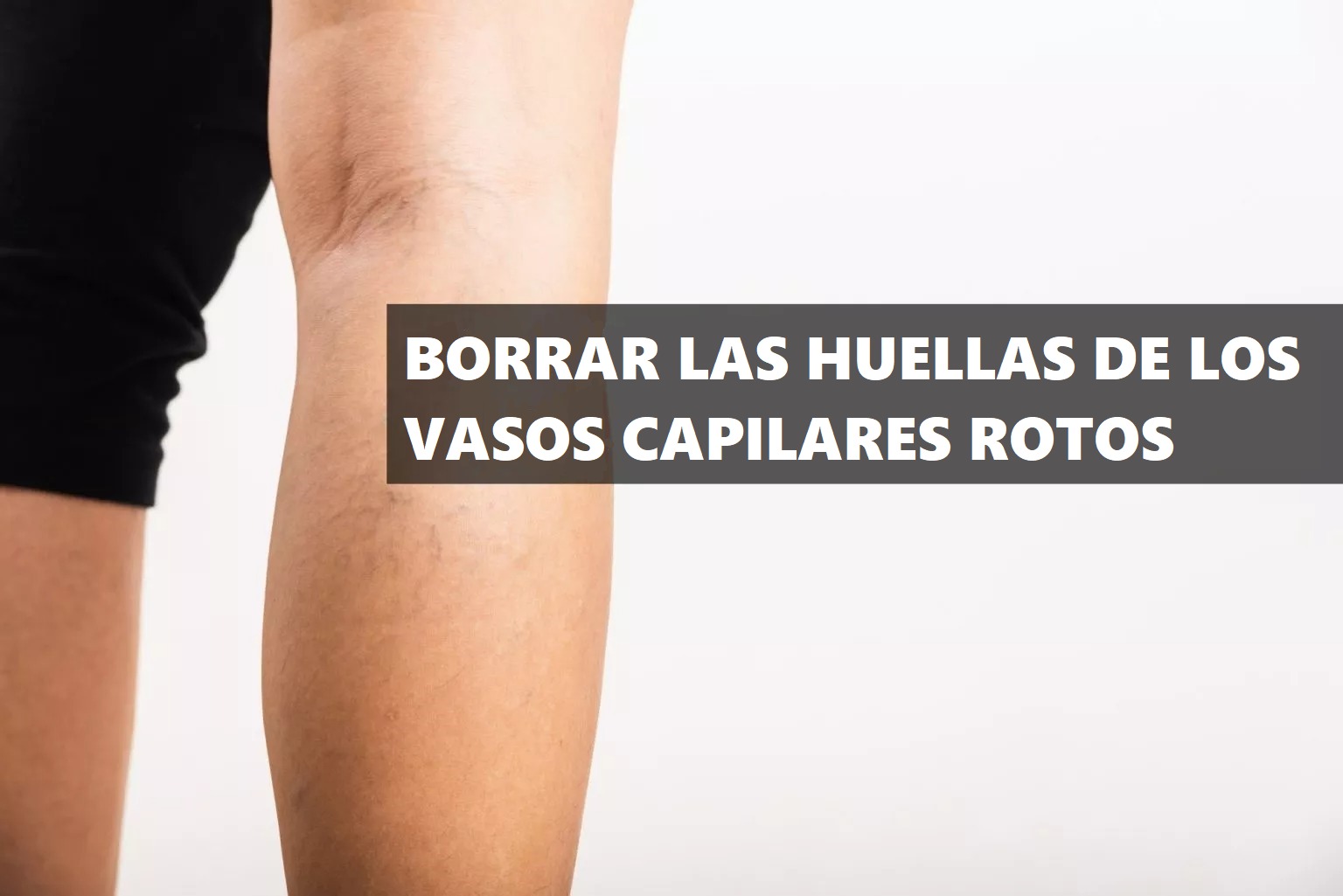 Vasos Capilares】 Claves para una Circulación Saludable